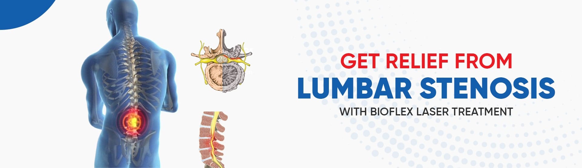 Lumbar Stenosis Treatment | Spinal Stenosis | BioFlex Pakistan