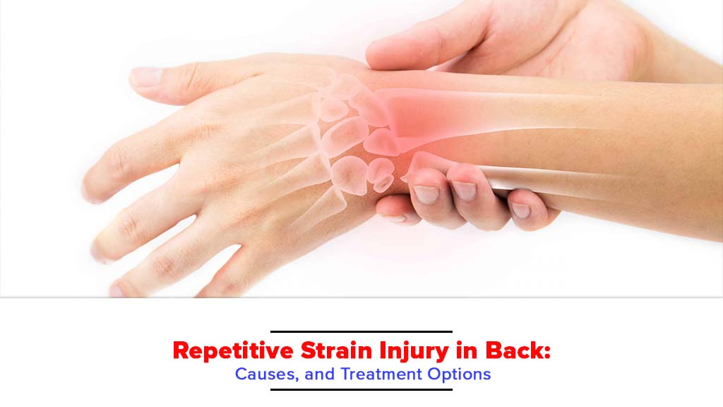 Repetitive Strain Injury in Back: Symptoms, Causes, and Treatment ...