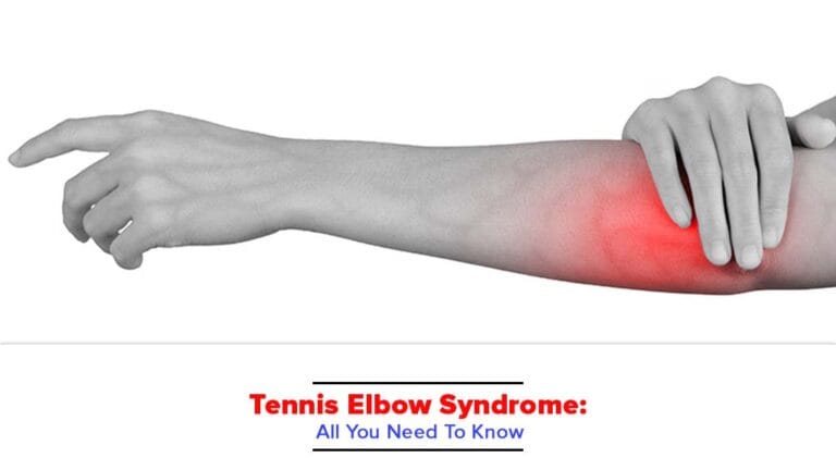 Tennis Elbow Syndrome: All You Need To Know | BioFlex Pakistan