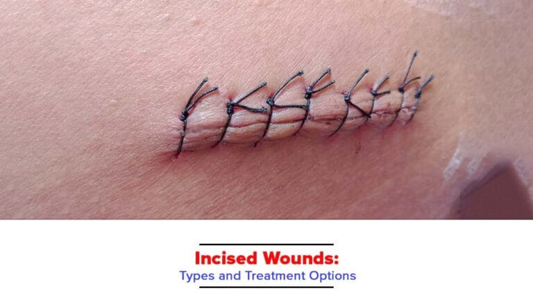 Incised Wounds: Types and Treatment Options | BioFlex Pakistan