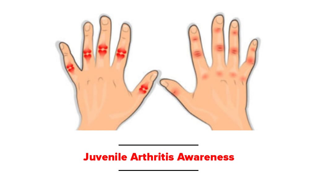 Juvenile Arthritis Awareness (JIA) | BioFlex Pakistan